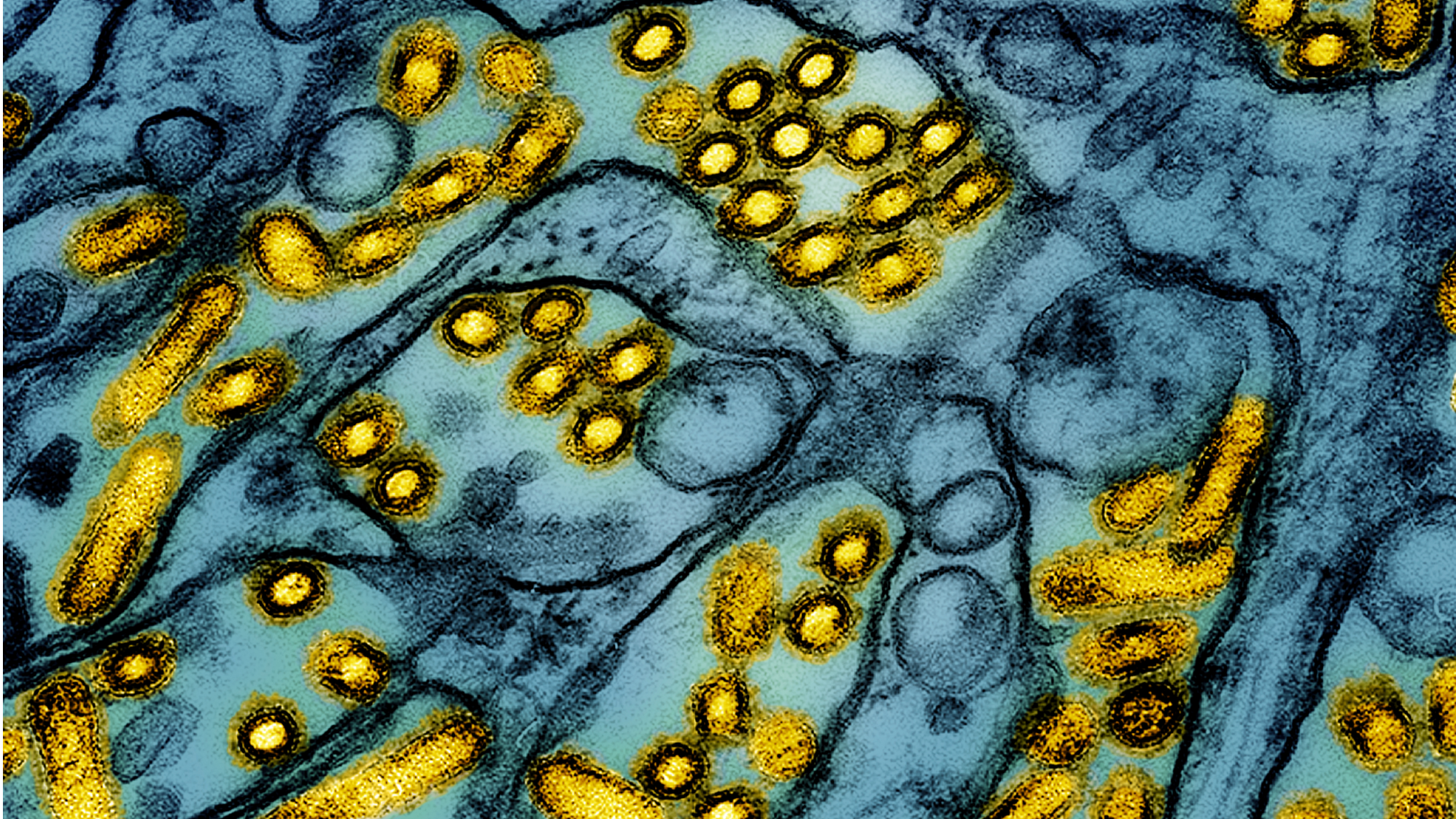 Canada detects its first presumptive human H5 bird flu case